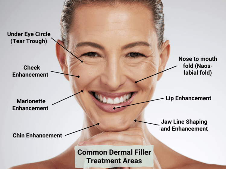 Dermal Fillers in Dubai – Guide to Facial Volume & Contouring